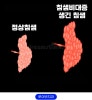 침샘비대증귀밑 턱밑 멍울 먹토부작용 얼굴형 없애는법 네이버 블로그